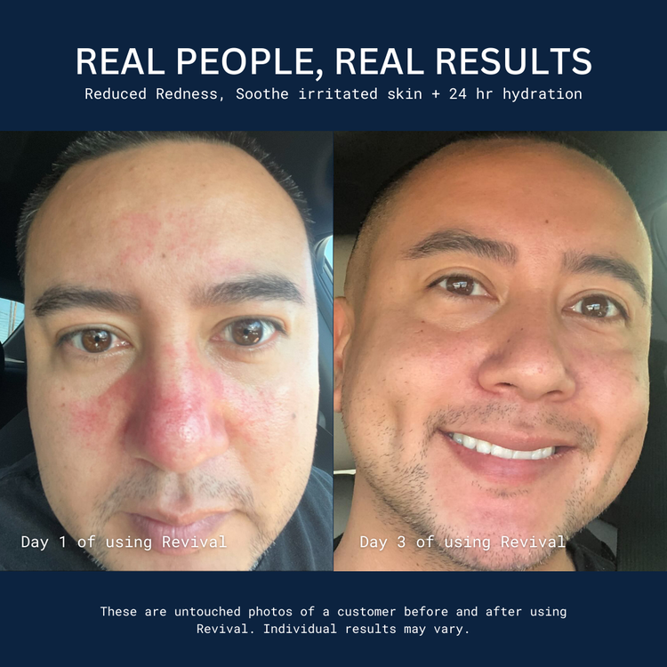 PrettyBoy | Simple Men's Skincare