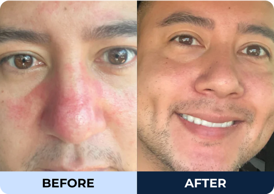 PrettyBoy | Simple Men's Skincare