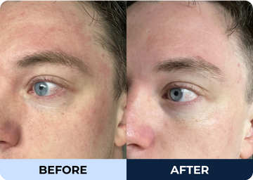 PrettyBoy | Simple Men's Skincare