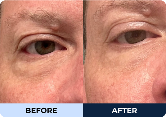 PrettyBoy | Simple Men's Skincare