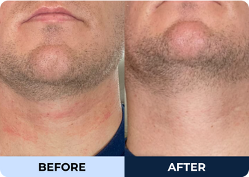 PrettyBoy | Simple Men's Skincare