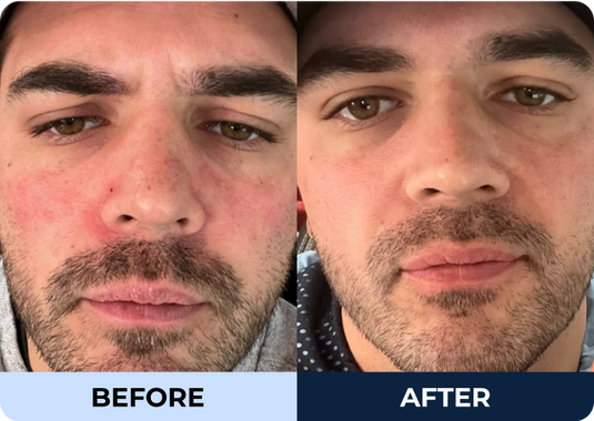 PrettyBoy | Simple Men's Skincare