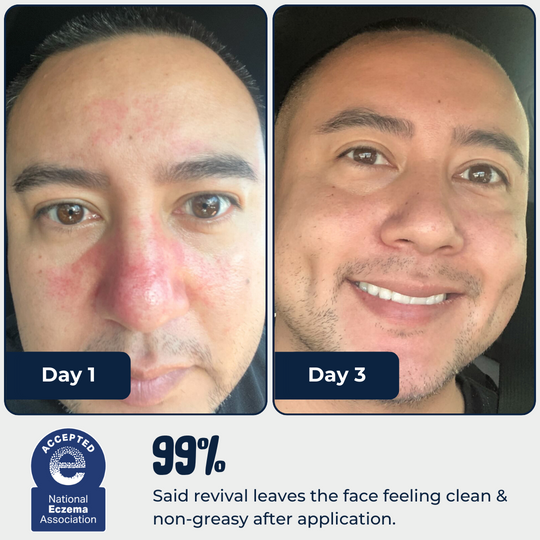 PrettyBoy | Simple Men's Skincare